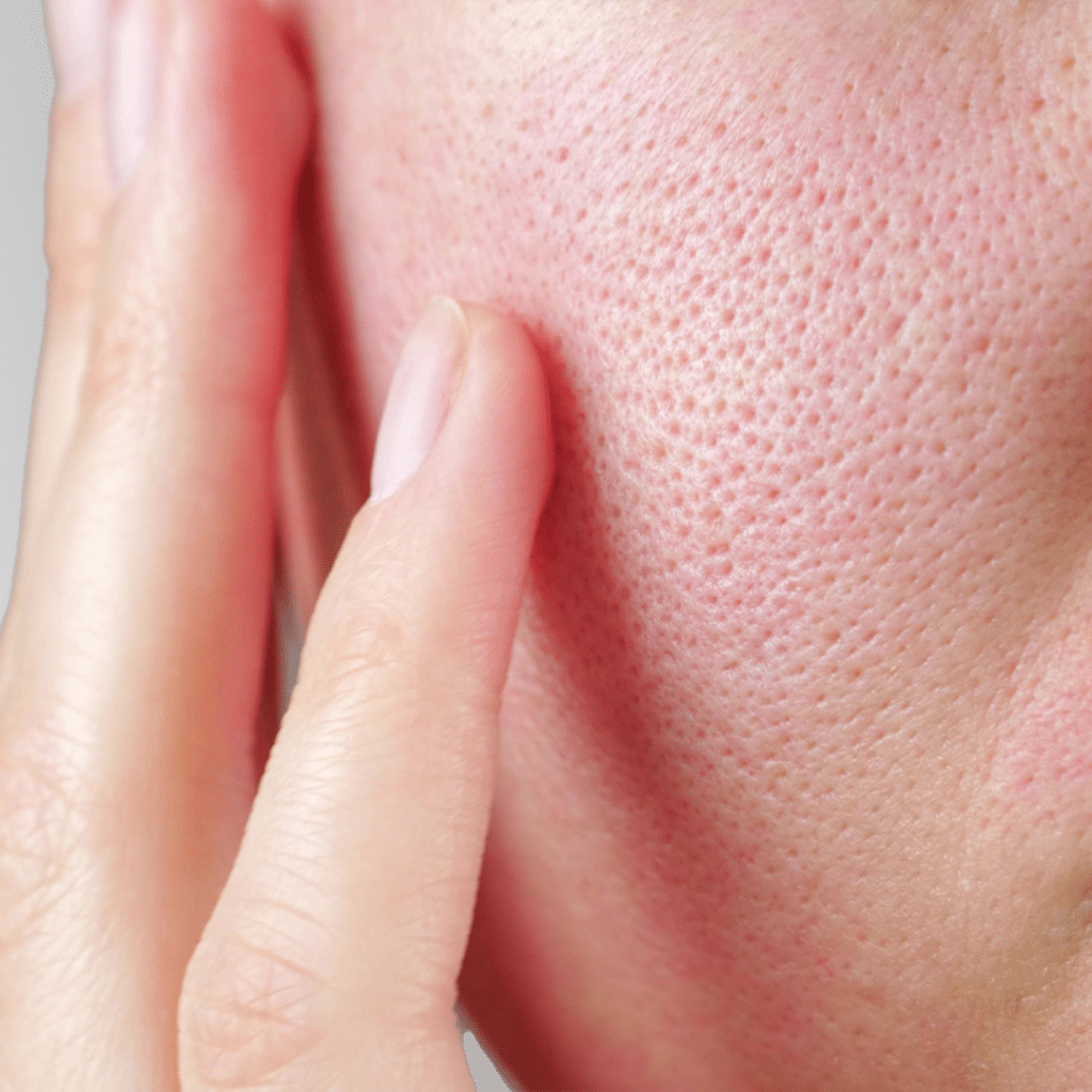 Skin Treatments | Borealis